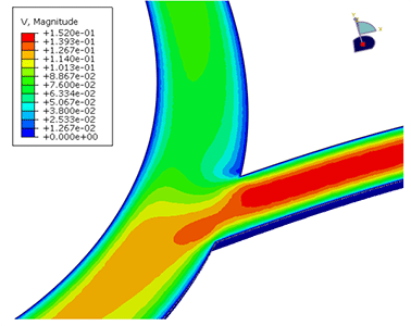 Abaqus Tutorial 20 - Pulsating Flow in a Bifurcated Vessel | TECHNIA ...